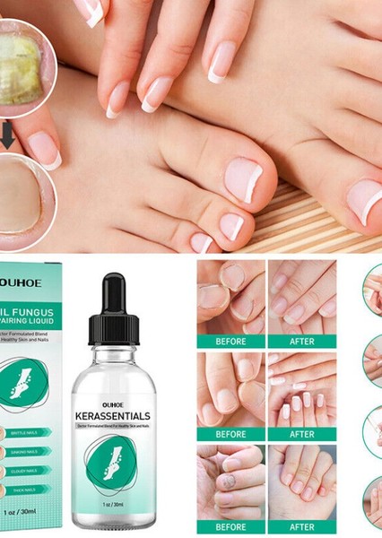 Kerassentials | Maybe you don't know Then Definitely Know Once! Fan ...